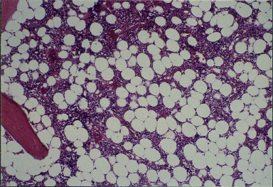 Bone marrow tissue (1)